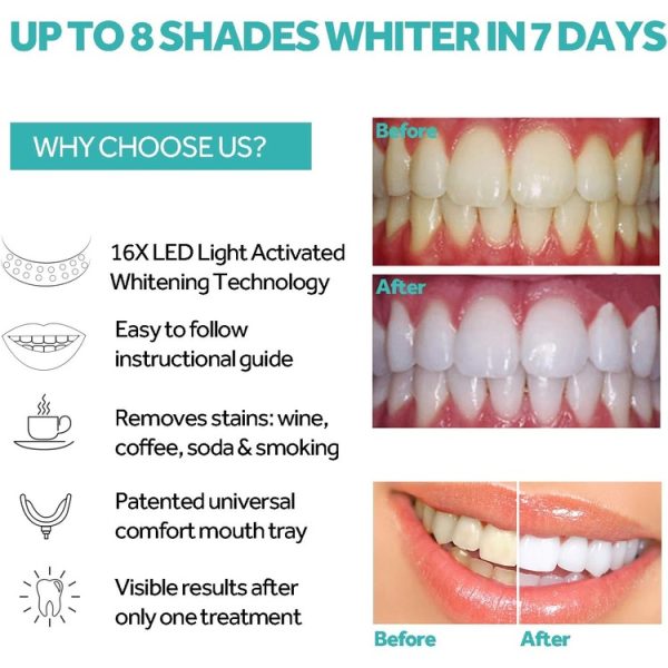 Teeth Whitening Light 16 LED Accelerator Light